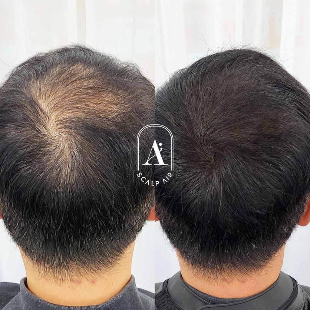 ScalpAir - J & i Tattoo Studio